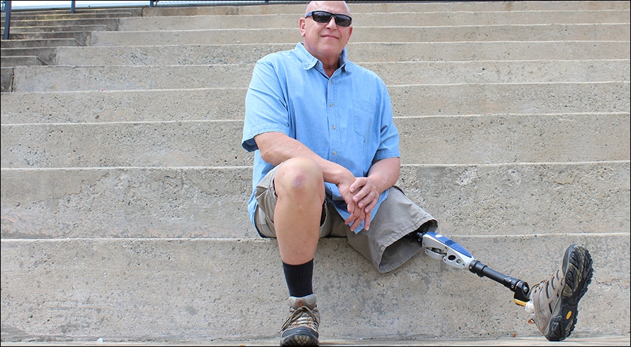 Oklahoma City Vctims of Catastrophic Injuries Leading to Amputation