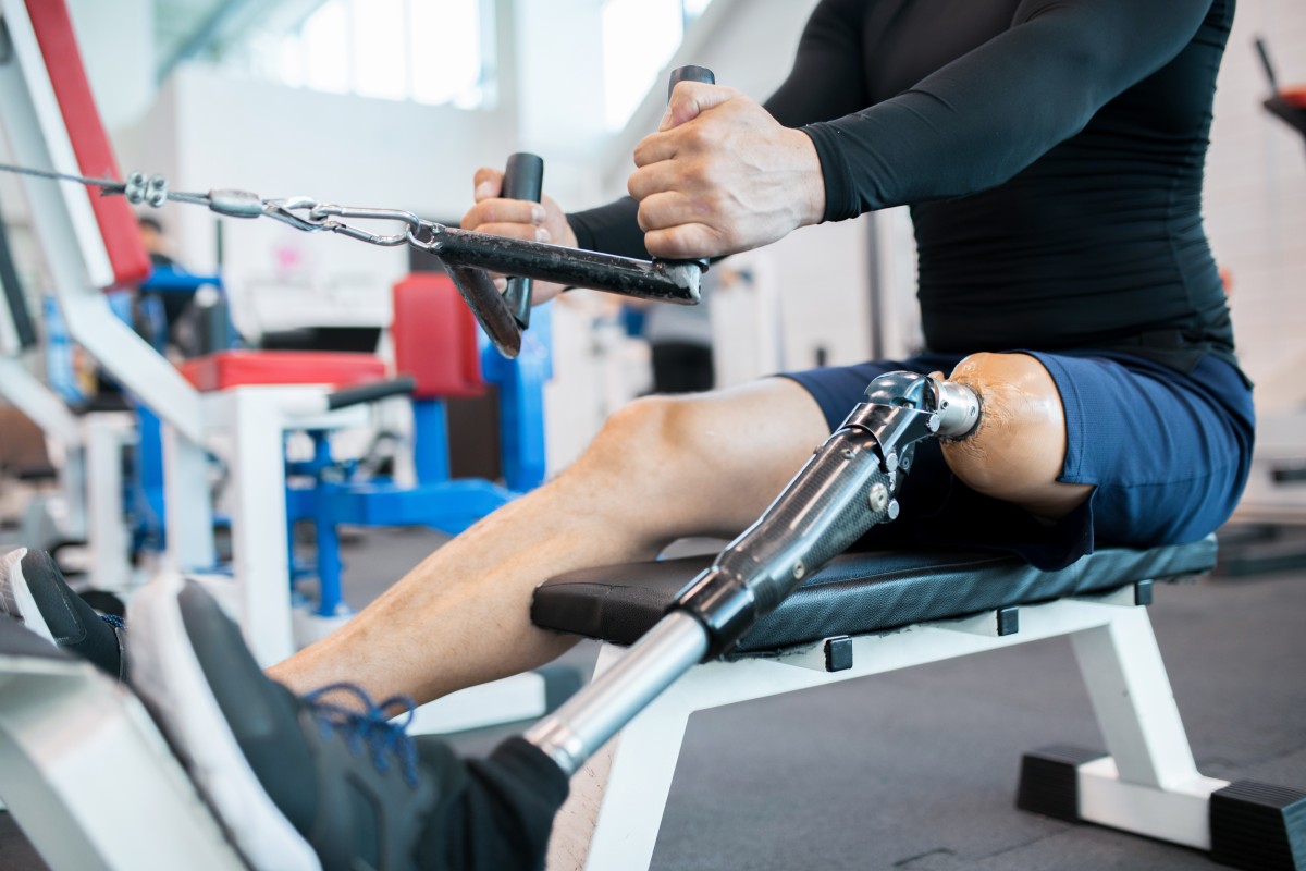 What Injury Victims Should Know Before Getting a Prosthetic Leg ...