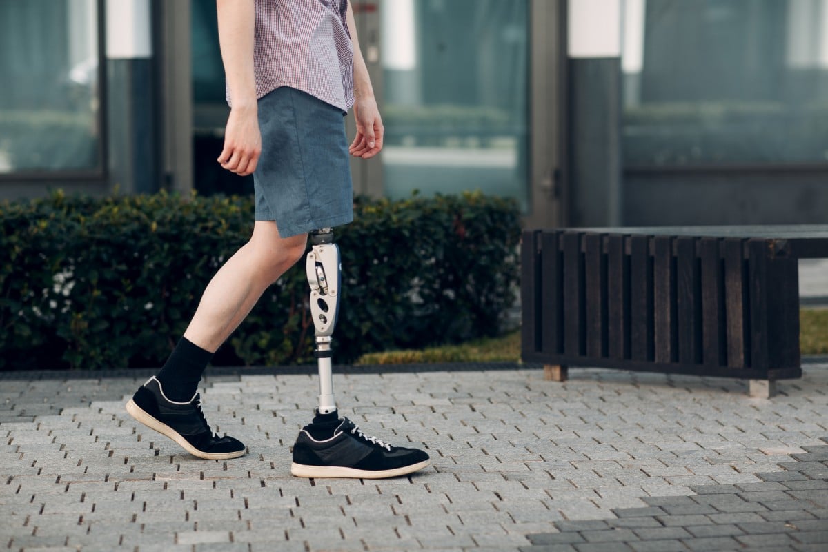 New Medical Advances in Prosthetic Technology - Cunningham & Mears